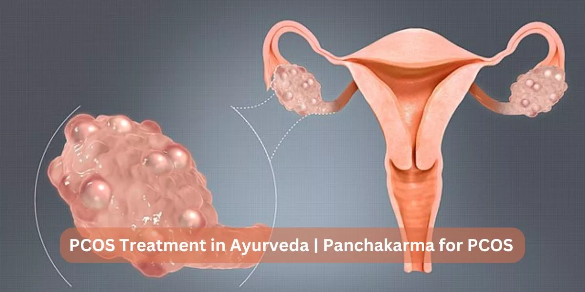 PCOS Treatment in Ayurveda | Panchakarma for PCOS